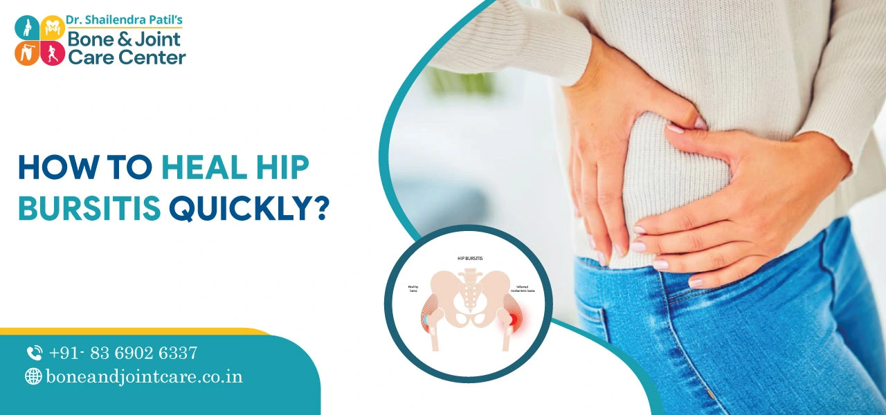 How to Heal Hip Bursitis Quickly?